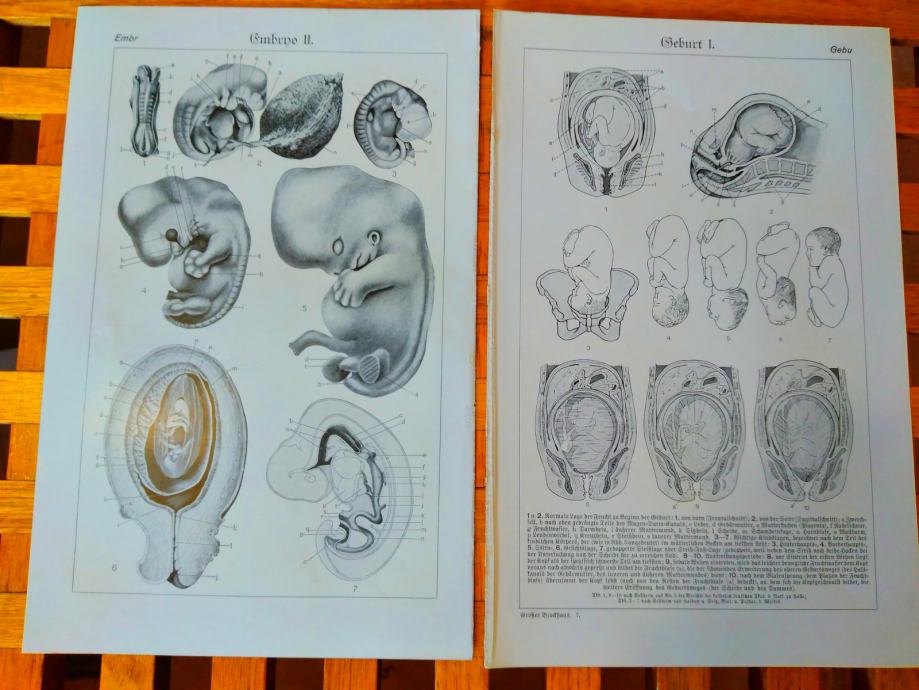 STARE LITOGRAFIJE ANATOMIJA LJUDSKOG TIJELA EMBRIO MATERNICA