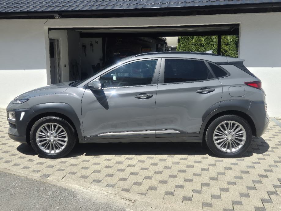 Hyundai Kona Automatik Probleme