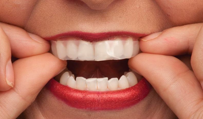 CREST PROFESSIONAL trakice za izbjeljivanje zubi kod kuće