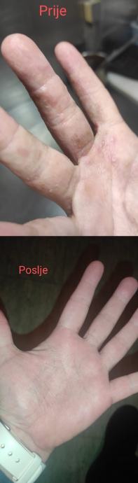 Kanabigerol cbg balzam & ulje, # kanabis cannabis konoplja cbd