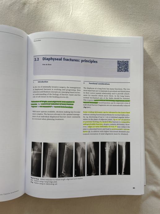 AO Principles of Fracture Management - 3rd Ed.