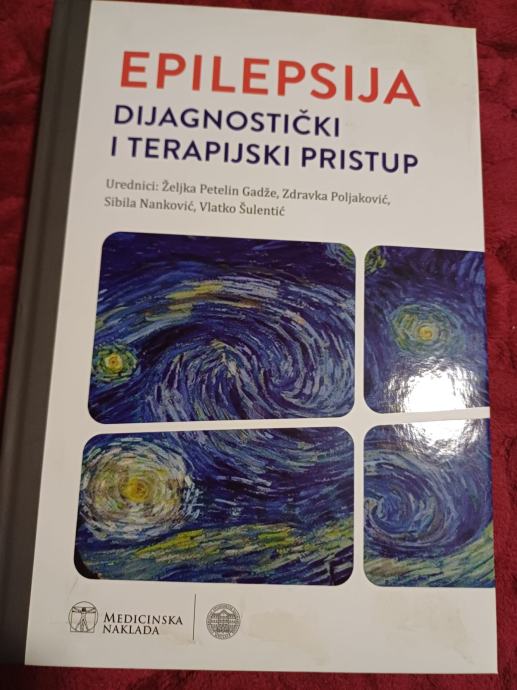 Epilepsija dijagnostički i terapijski pristup