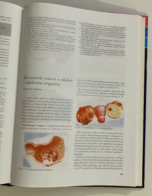 Velimir Šimunić i suradnici - Ginekologija #3