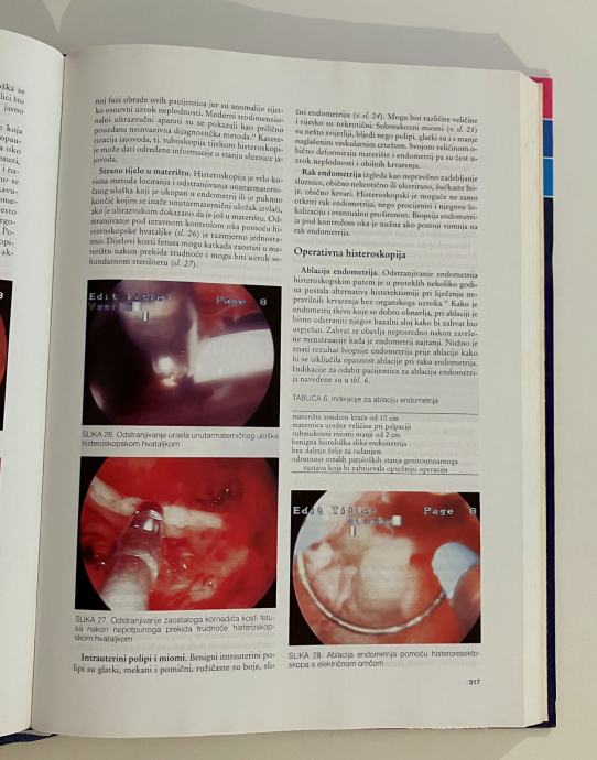 Velimir Šimunić i suradnici - Ginekologija #3