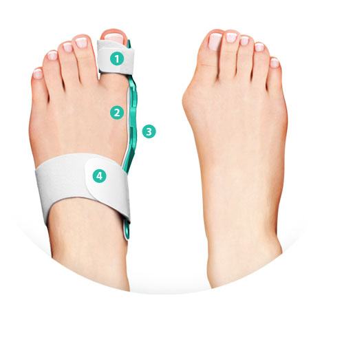 MOBILNA ORTOZA DNEVNA NOĆNA čukalj hallux valgus 1 PAR 170,00 kn