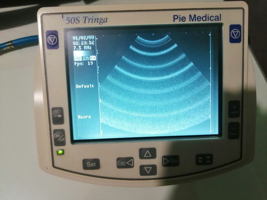 Prijenosni ultrazvuk Pie Medical 50S Tringa