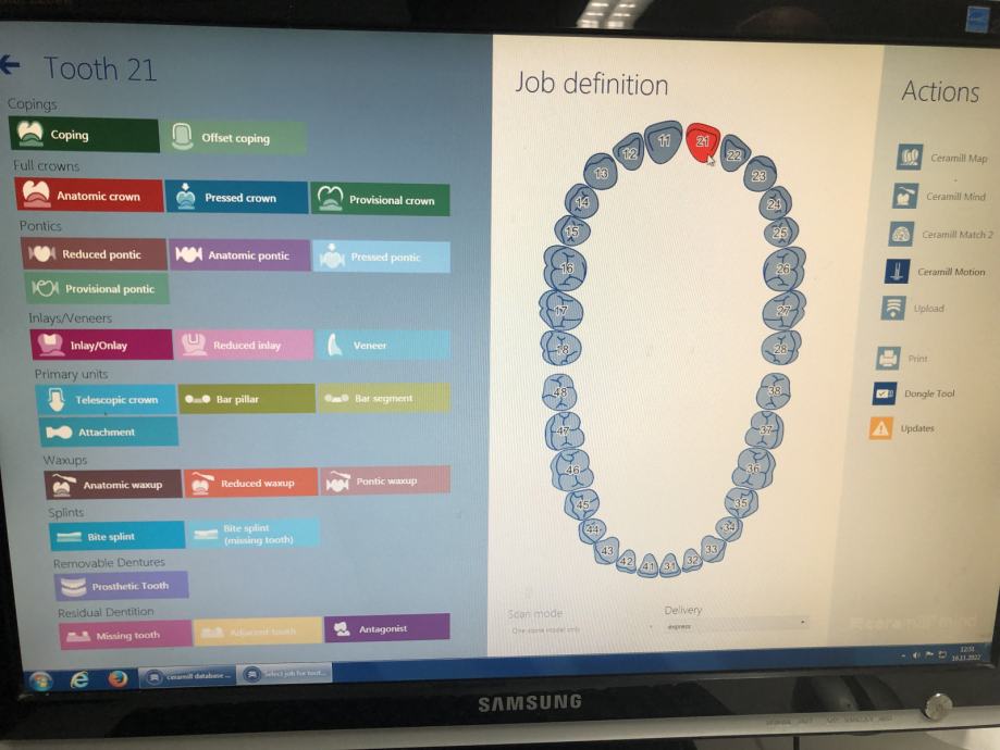 Zubotehnicki cad/cam Amann Girrbach Dental 3D Scanner Ceramill map 300