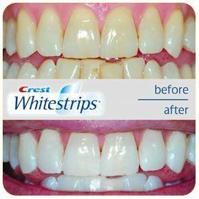 Crest whitestrips trakice za izbjeljivanje zubi Professional