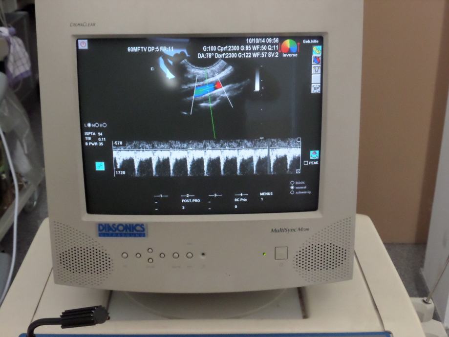 Diasonics Synergy - Color Doppler Ultrazvuk Ultrazvucni Aparat
