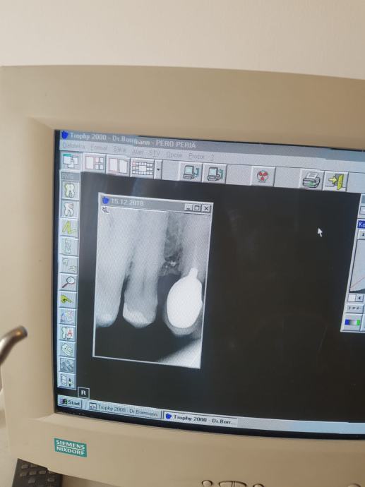 RVG Trophy kamera STV 2 profesionalna Zagreb