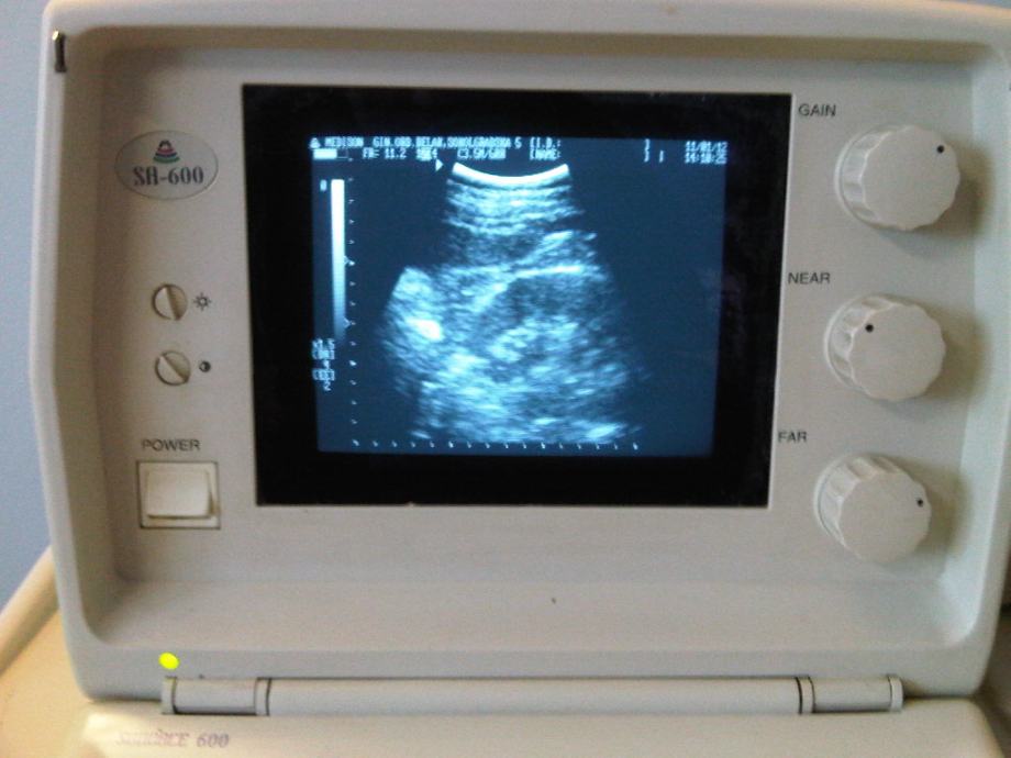 ULTRAZVUČNI PRIJENOSNI APARAT SONOACE 600, 3 sonde