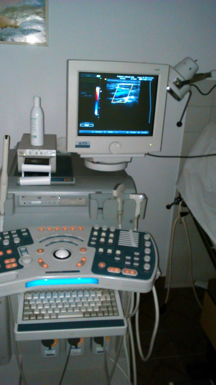 Ultrazvuk 3D Color Doppler Sonoace SA 9900