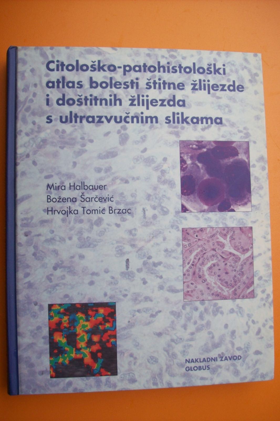 CITOLOŠKO-PATOHISTOLOŠKI ATLAS BOLESTI ŠTITNE ŽLIJEZDE I DOŠTITNIH ŽL.