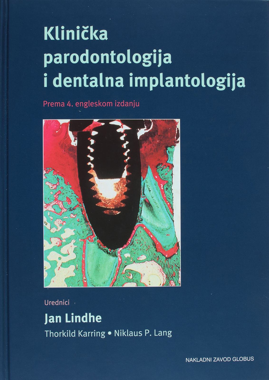 Jan Lindhe i suradnici – KLINIČKA PARODONTOLOGIJA I DENTALNA IMPLANTOL