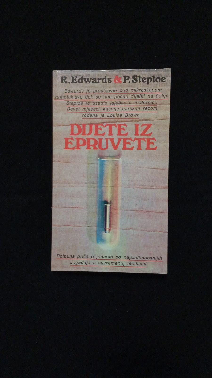 DIJETE IZ EPRUVETE