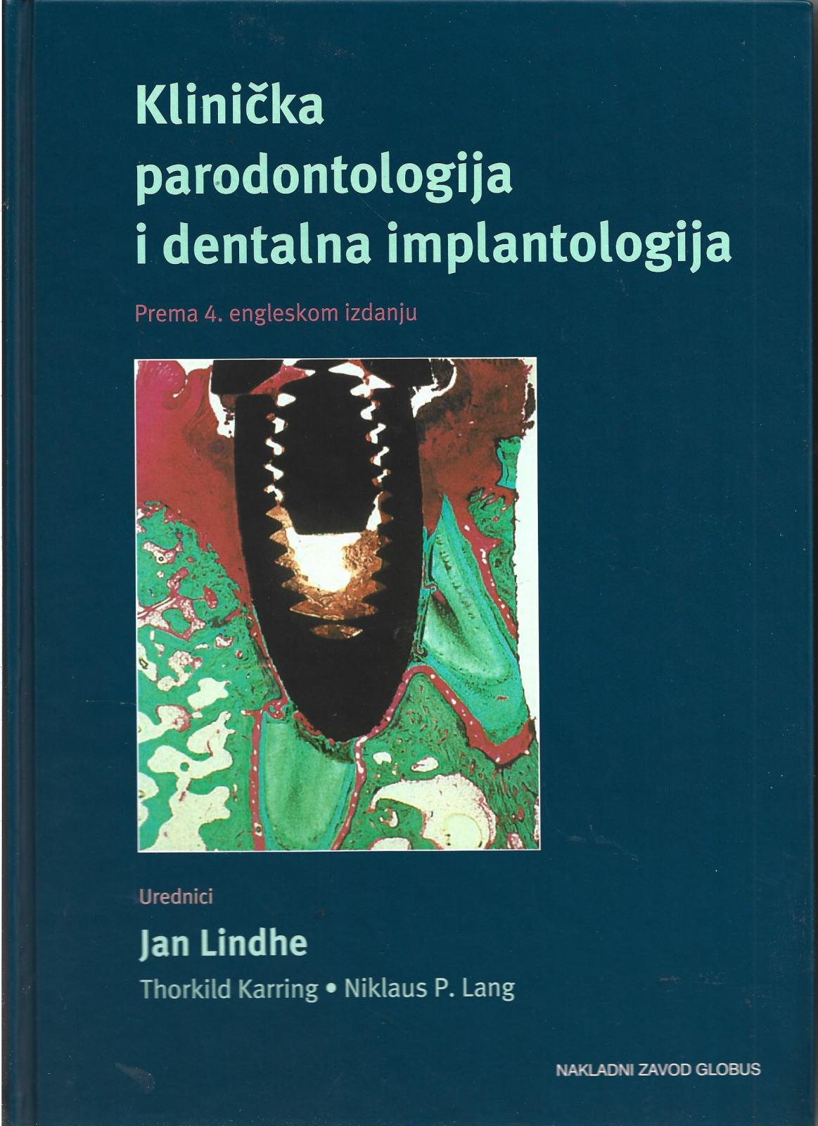 KLINIČKA PARADONTOLOGIJA I DENTALNA IMPLANTOLOGIJA - Jan Lindhe