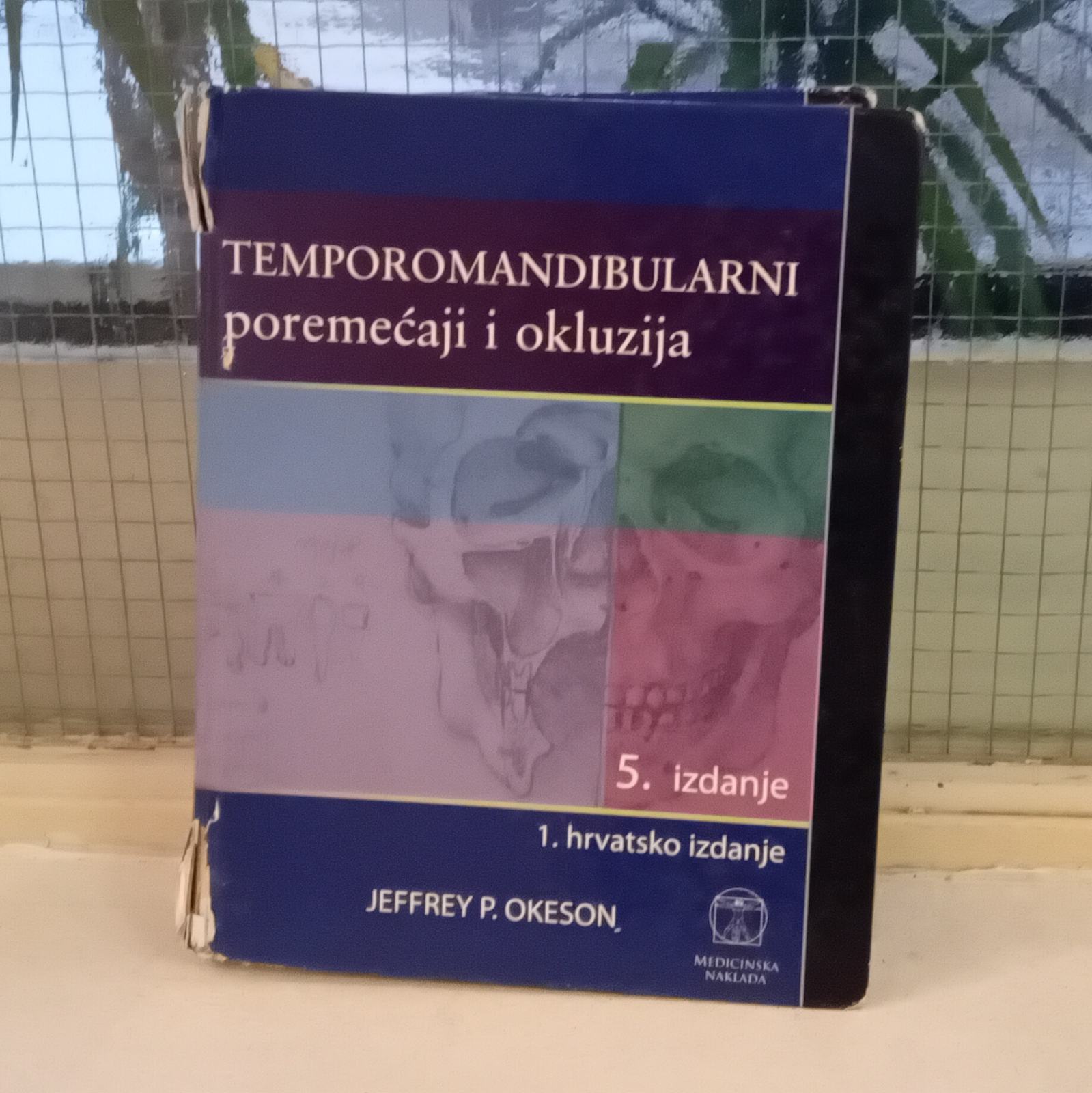 TEMPOROMANDIBULARNI POREMEĆAJI I OKLUZIJA, OKESON