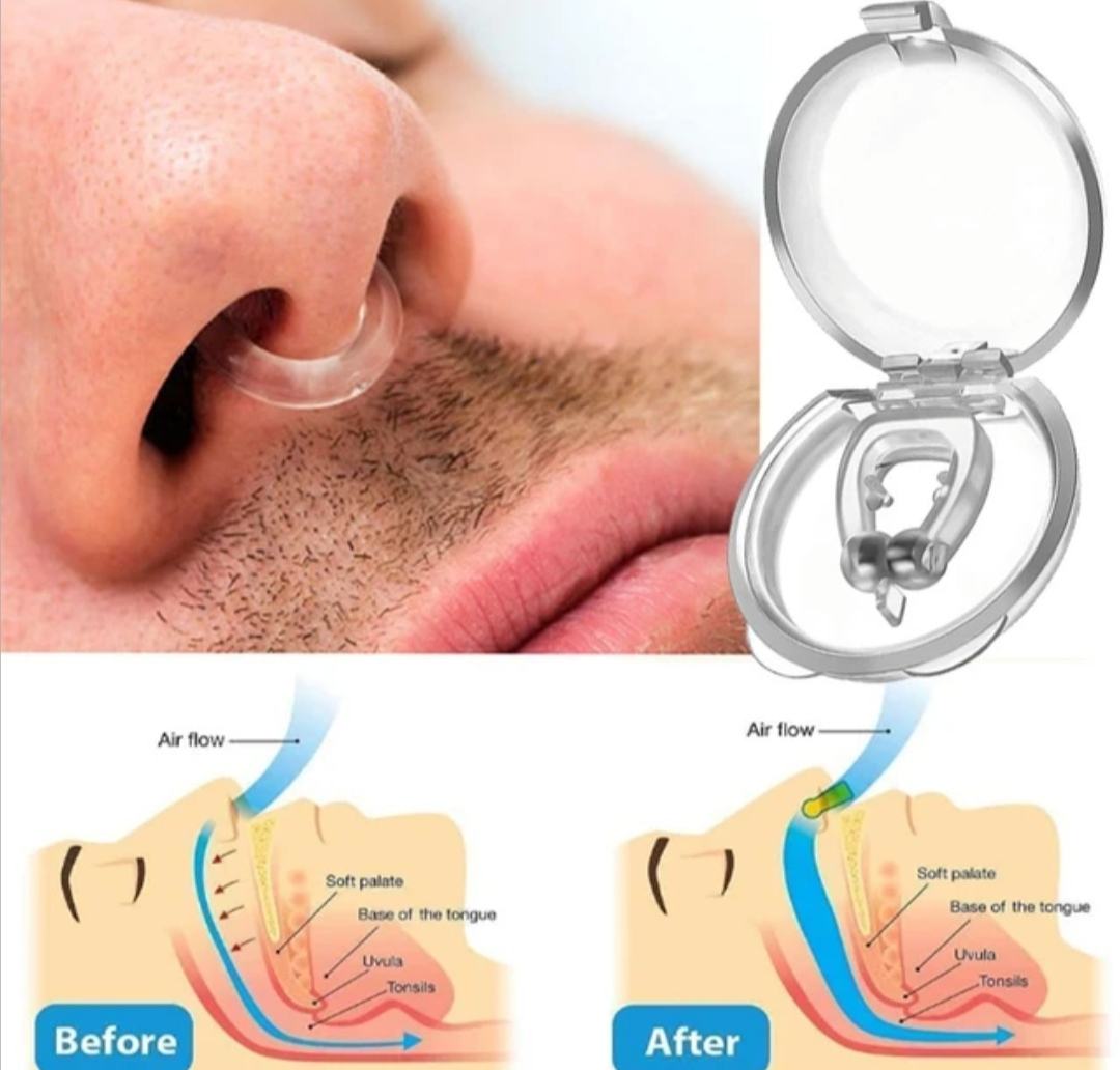 STOP HRKANJU Kopče za Nos