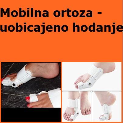 MOBILNA ORTOZA DNEVNA NOĆNA čukalj hallux valgus 1 PAR 170,00 kn