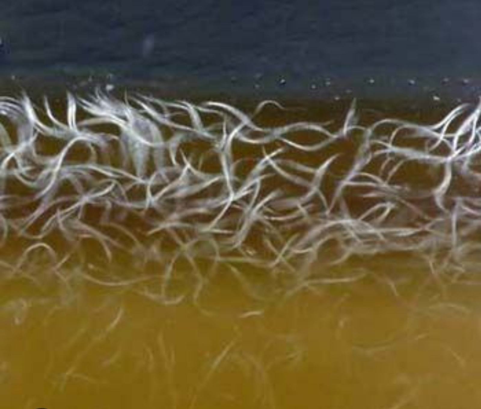 Mikro crvi i octene jegulje kulture