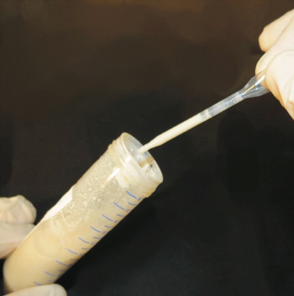 Test za proljev teladi